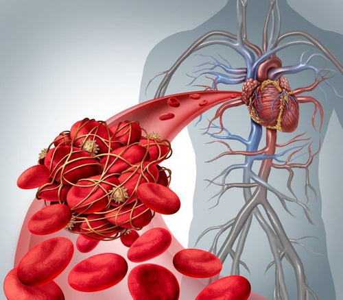 Coagulation Disorders: An Overview of Common Conditions | Medical Notes
